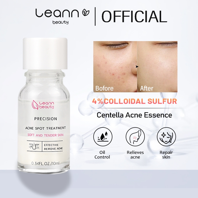 Leann Beauty Acne Precision Spot Treatment 10ml | Fast Acne Control ...
