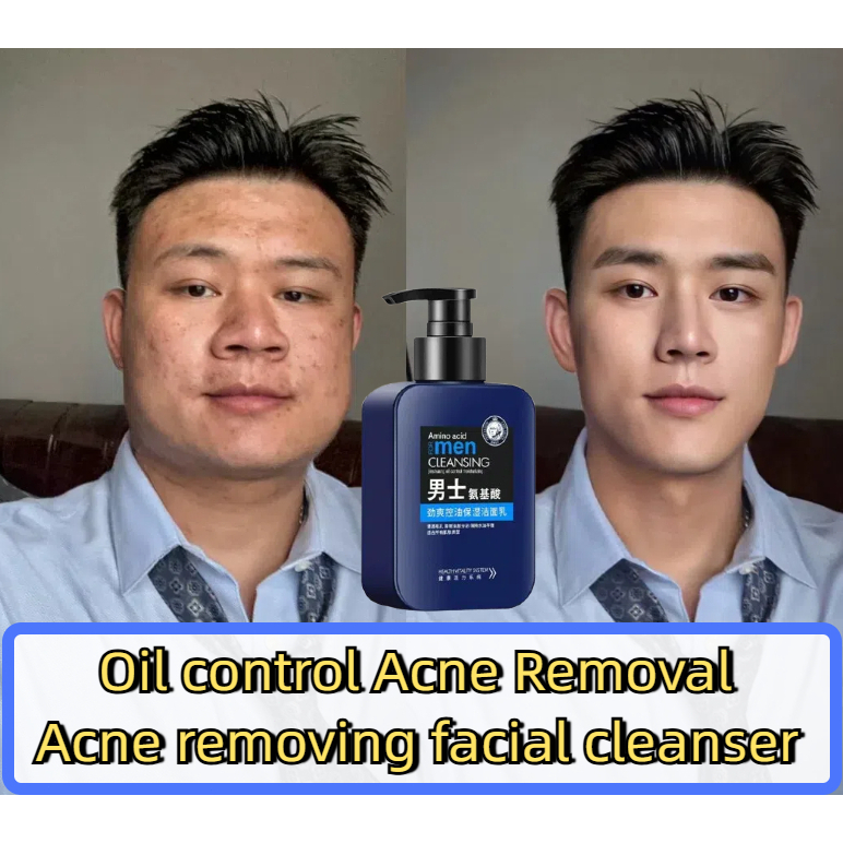 😎 Pencuci Muka Lelaki | Men Acne Facial Cleanser | Oil Control & Deep ...