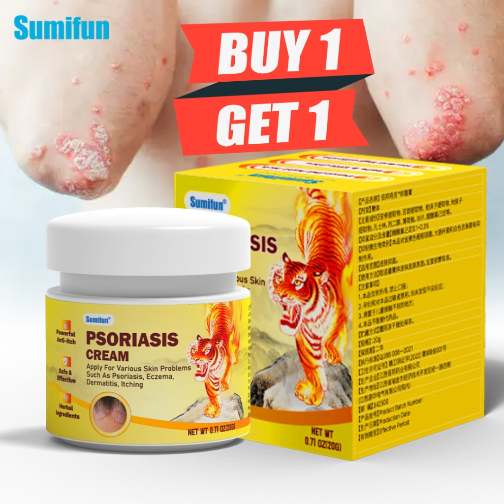 Psoriasis Cream Antifungal cream ubat gatal kulit tiger balm Itchy Skin ...