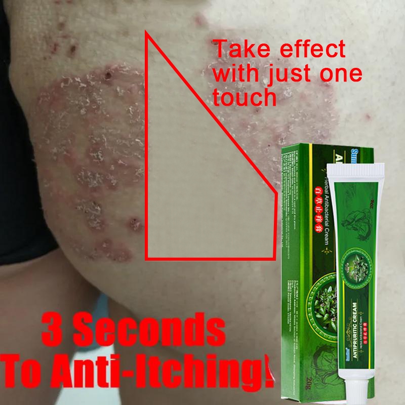 20g Antipruritic Cream Antibacterial Herbal Treatment for Skin Moss ...