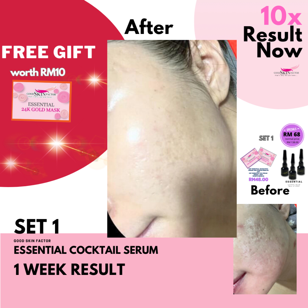 Trial Set 1 GSF Cocktail Serum Set-Parut/Jeragat/Pigmentasi/PIE PIH ...