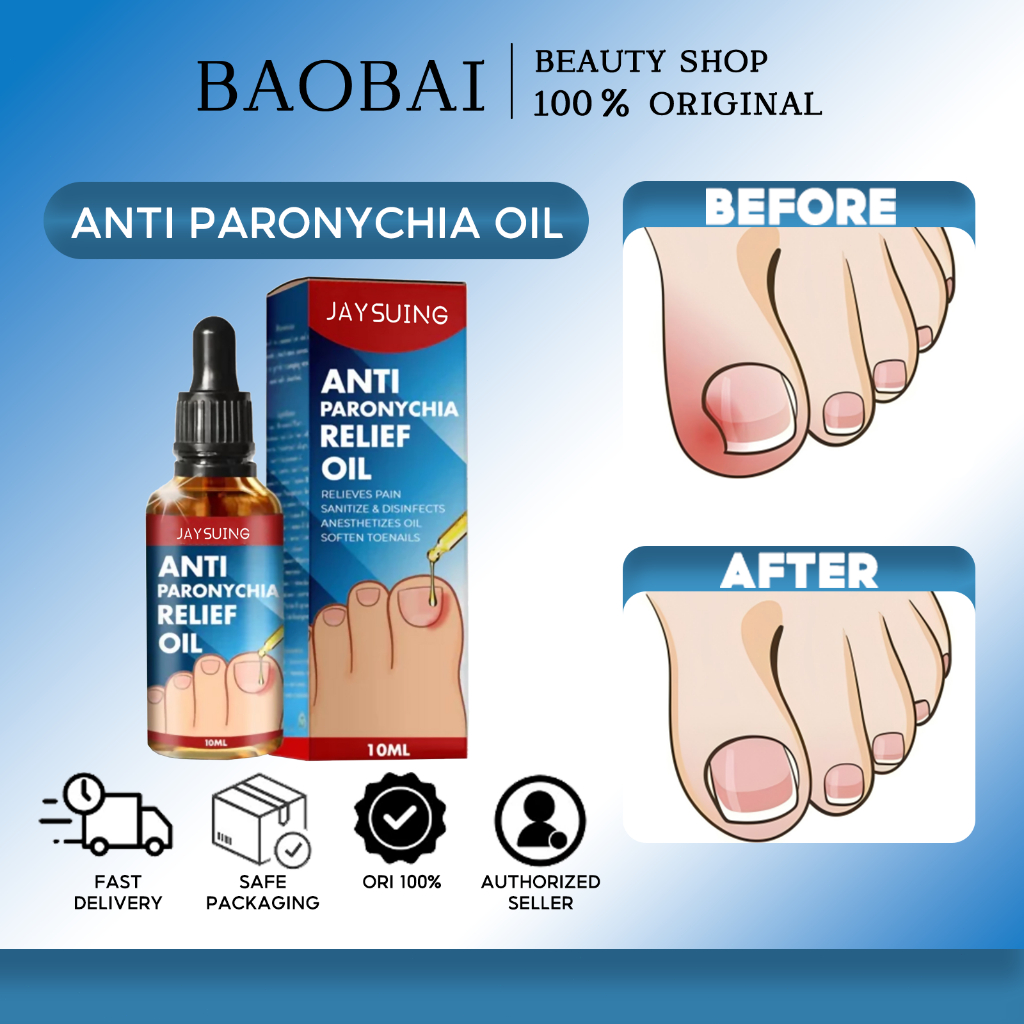Jaysuing Anti Paronychia Relief Oil Ingrown Toenail Anti Fungal Toe Nail Ingrown Corrector ...