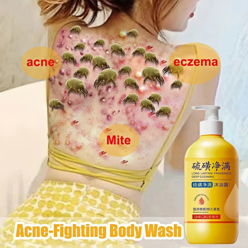 Sulfur body wash antibacterial body wash Anti Mite Anti acne eczema body wash sabun sulfur untuk ...