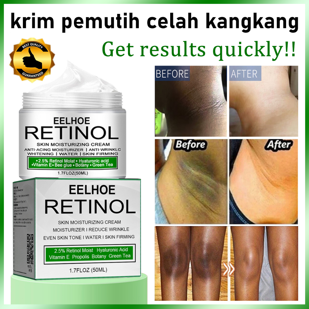 Krim pemutih miss v whitening pemutih celah kangkang putihkan kulit ...