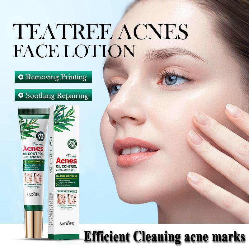 Tea Tree Acne Control Face Gel Hydrating Moisturizing Gel 20g | Shopee ...