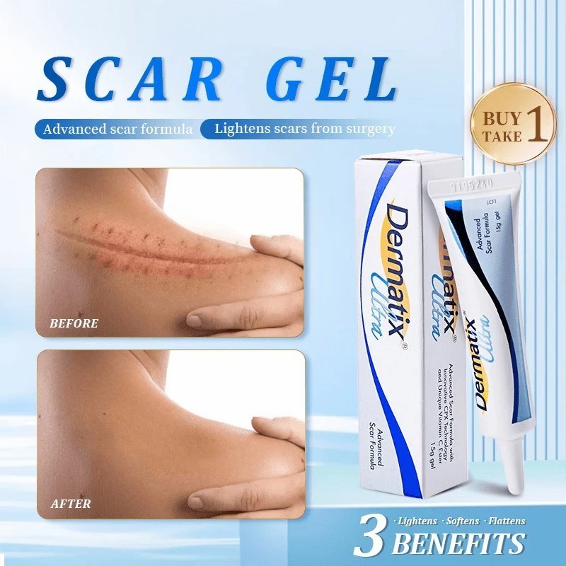 Hilangkan Parut Hitam Stretch Mark Cream Scar Removal Mosquito Bite ...