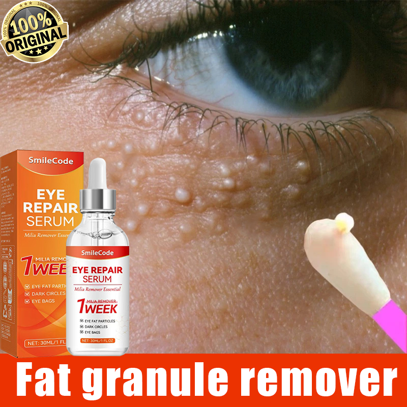Fat Granule Remover Milia Seed Remover Syringoma Milia Reemover Grease ...