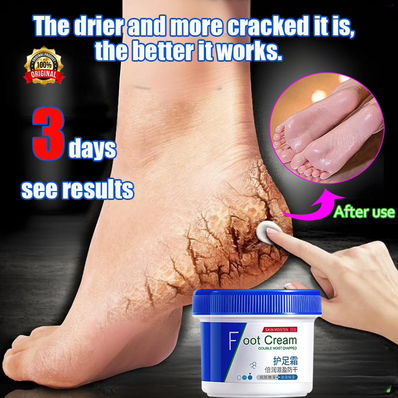 foot cream krim tumit kaki merekah foot cream crack heel 50g Anti ...