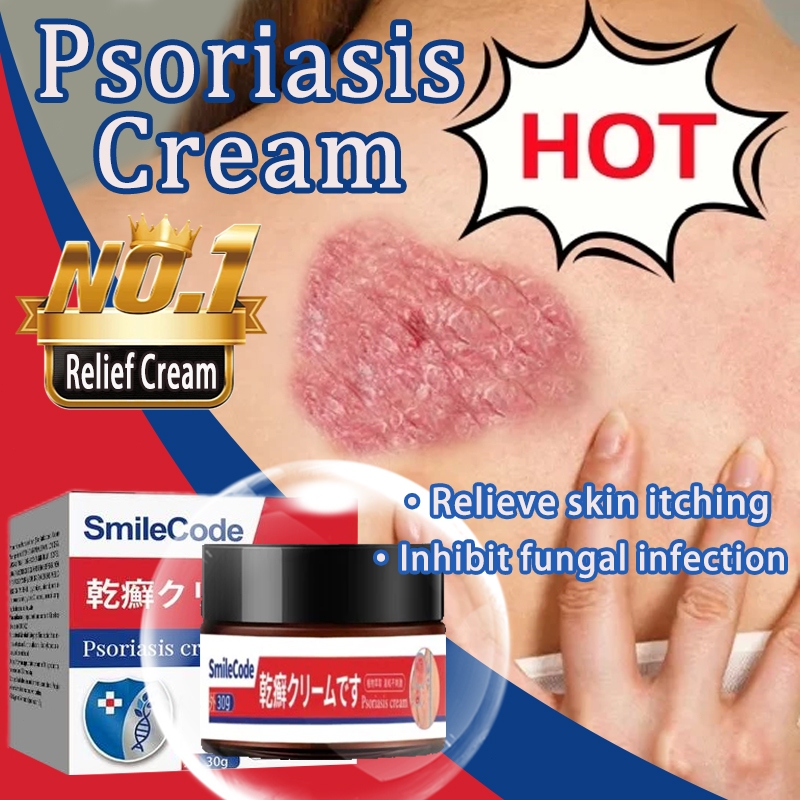 Psoriasis Cream Antifungal cream Eczema cream Cream gatal kulit 20g ...