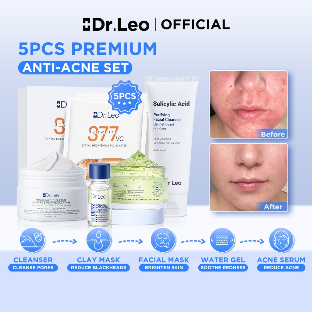Dr.Leo Acne Treatment 5pcs Set Acne Essence+Facial Cleanser+377 Facial ...