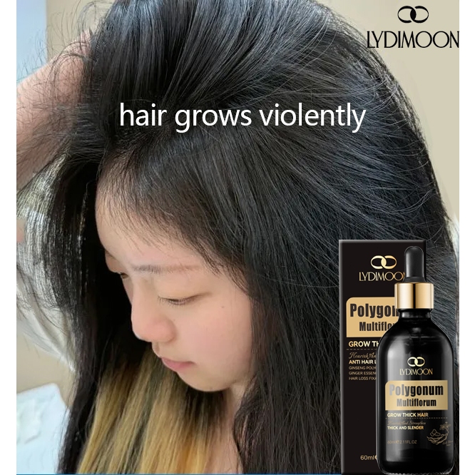Polygonum Multiflorum Black Hair Serum Hair Growth Serum Herbal Hair ...