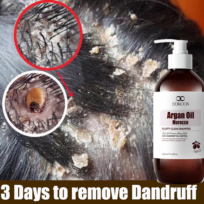 Argan Shampoo kutu rambut lice shampoo anti dandruff Oil Control ...