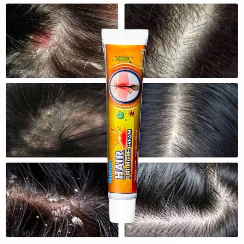 HAIR FOLLICLE CREAM Terapi rawatan kulit kepala rambut bulu ...