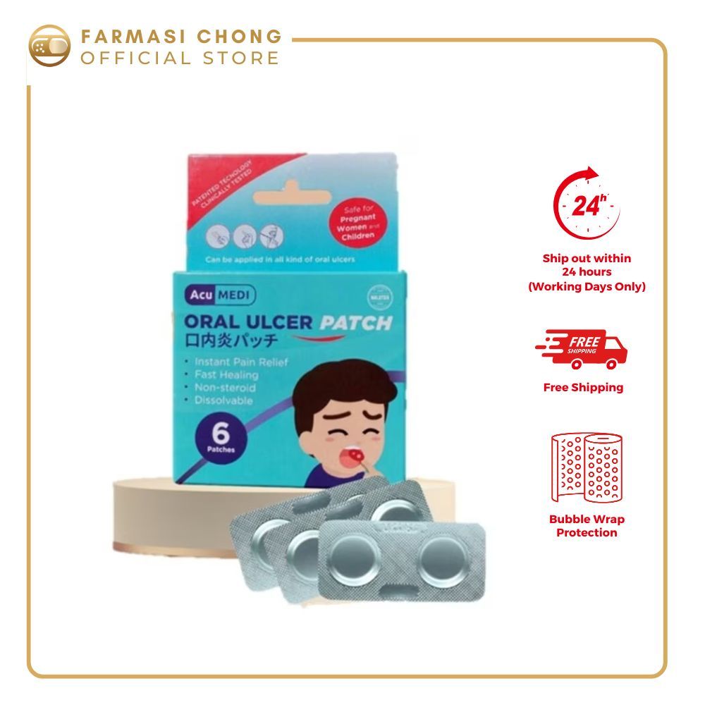 AcuMEDI Oral Ulcer Patch 6s | Shopee Malaysia