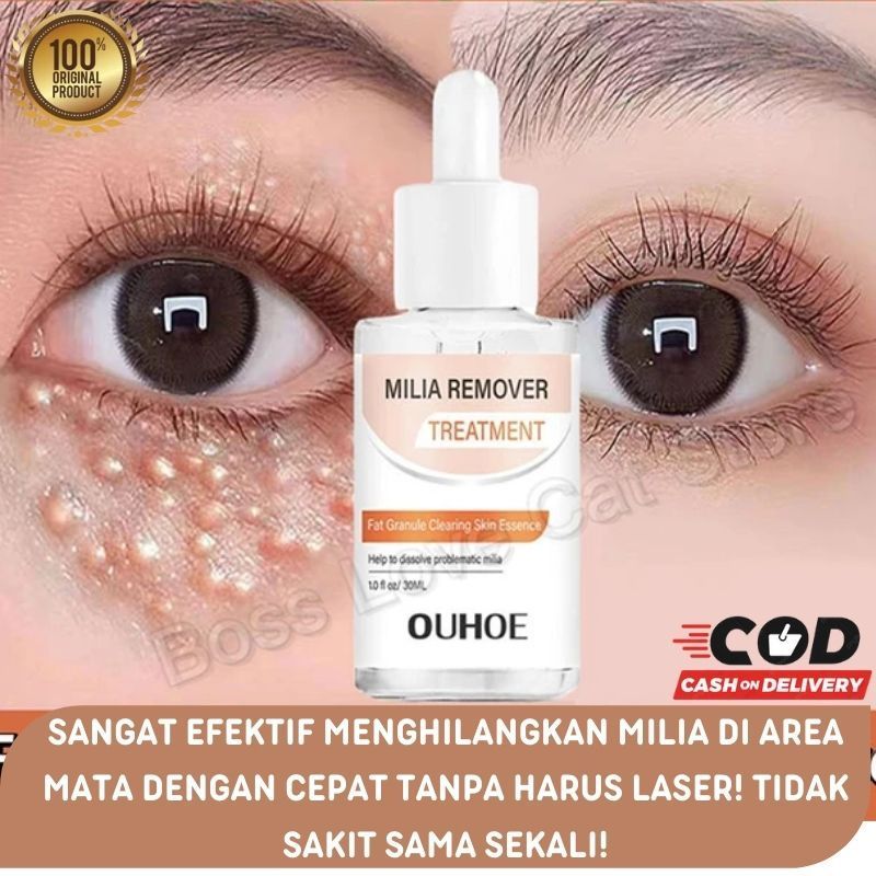 Milia Seed Remover Fat Granule Syringoma Milia Remover Grease Grains ...