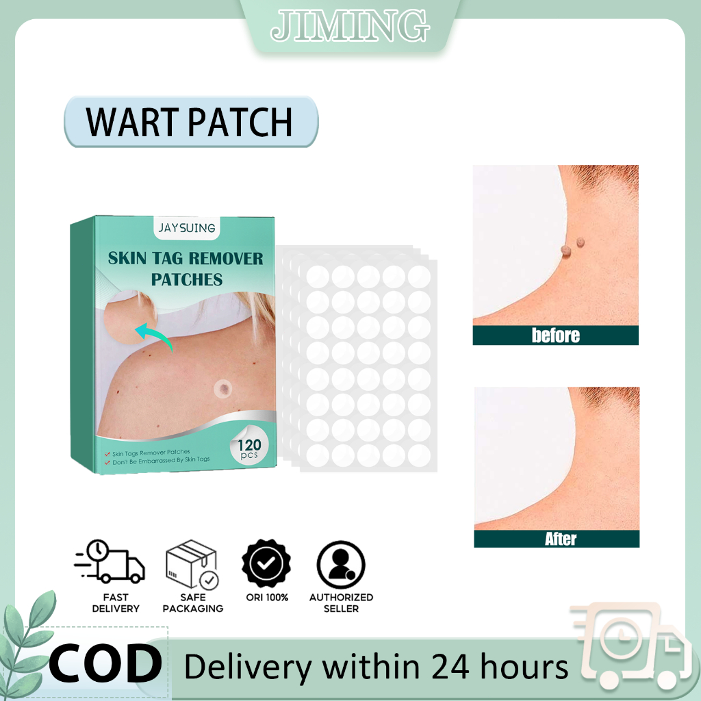 Wart Tag Removal Stickers Skin Tag Mole Stickers Skin Repair ...