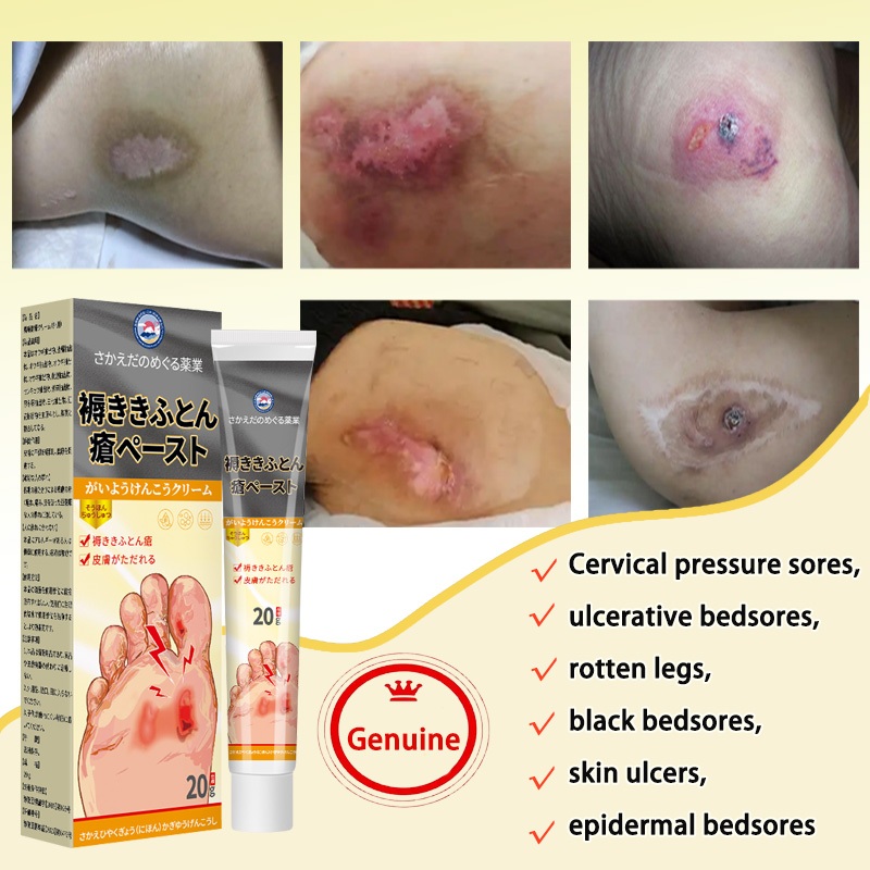 Bedsore Treatment Cream Pressure Sore Ulcer Skin Rot Necrotic repair ...