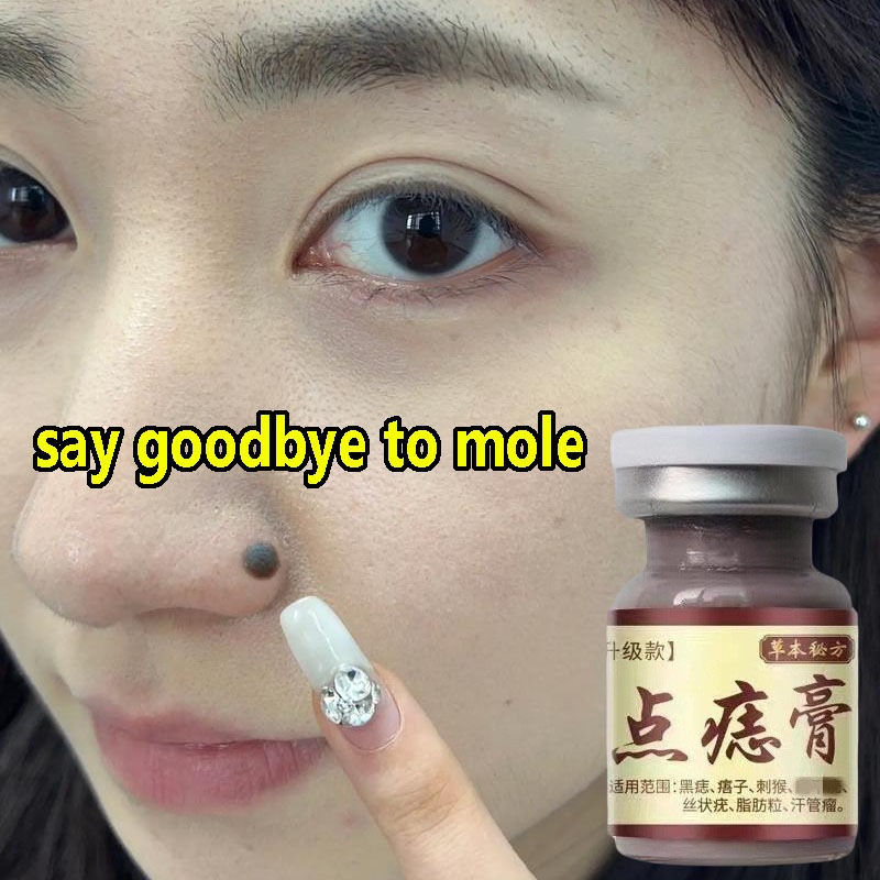 【Effective in 3 days】Mole dropping Cream skin tag removal cream Wart ...