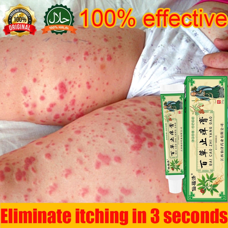 krim gatal kulit eczema cream psoriasis cream Herbal antibacterial Anti ...