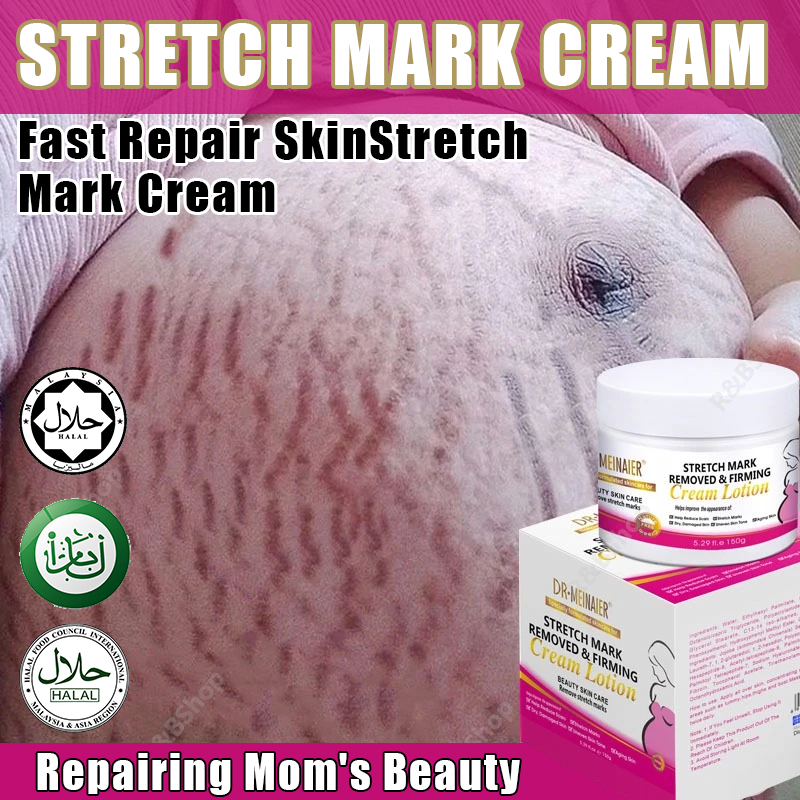 Stretch Mark Cream Pregnancy Cream Maternity Cream 150g Remove Stretch ...
