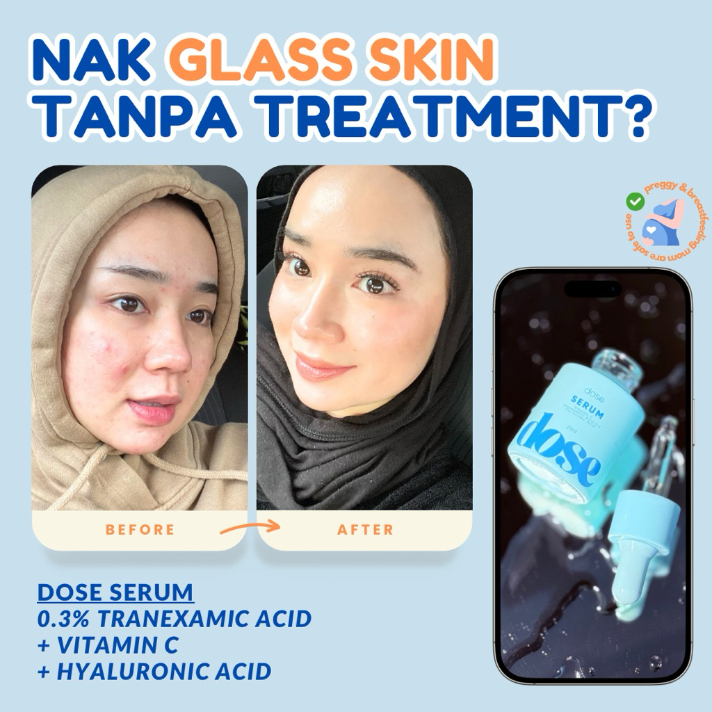 DOSE SERUM - 0.3% Tranexamic Acid + Vitamin C | Shopee Malaysia
