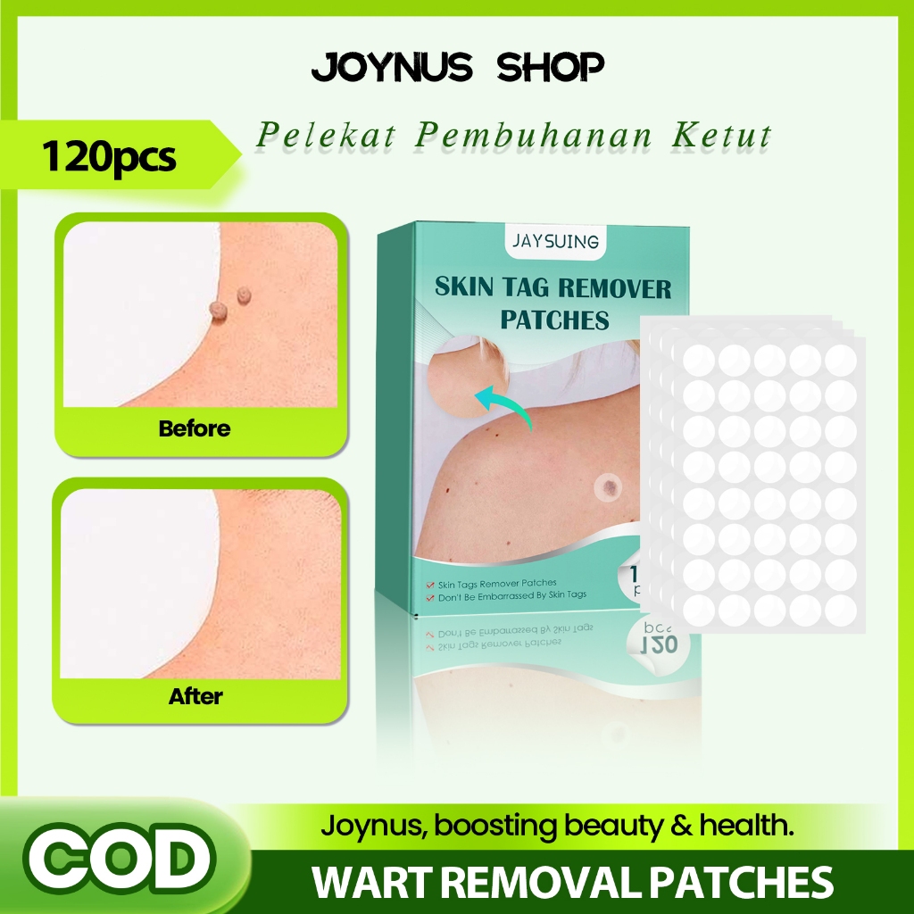 Wart Removal Patches 120pcs Remove warts Pelekat Ketuat Skin cleansing ...