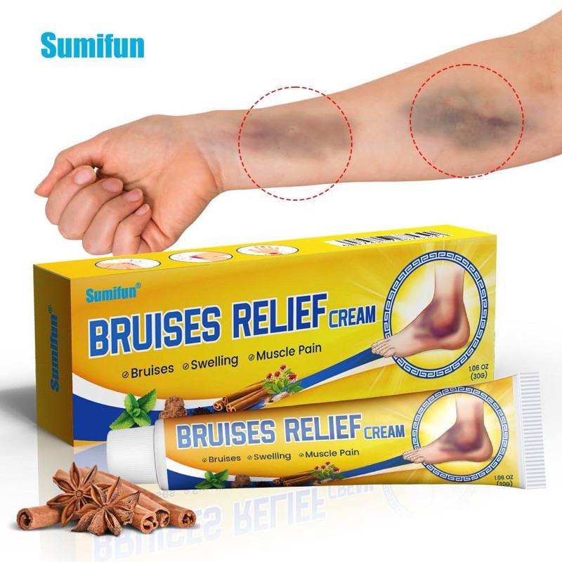 BRUISES RELIEF CREAM penghilang lebam bengkak kecutkan bengkak ...