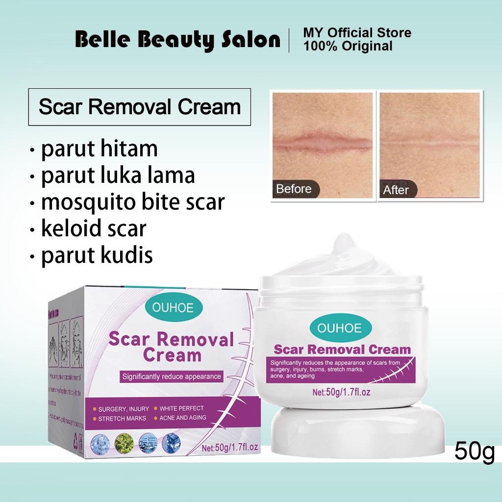 Scar Removal Cream 50g Repair Old Scars Ubat Hilangkan Parut Scald ...