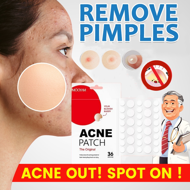 Acne Patch Pimple Patch Sticker Jerawat Pelekat Jerawat Pimple Patch ...
