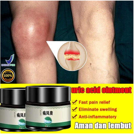 gout ointment ubat gout 35g Natural Chinese herbal medicine gout ...