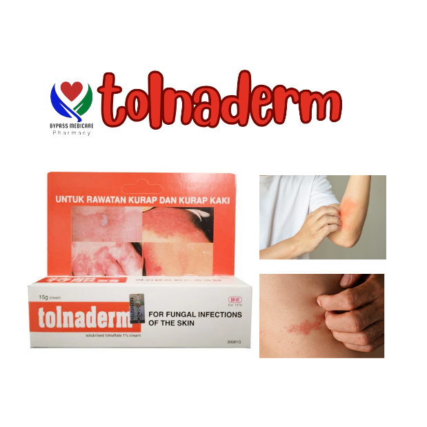 Tolnaderm Cream 15g For Fungal infections of The Skin | Shopee Malaysia
