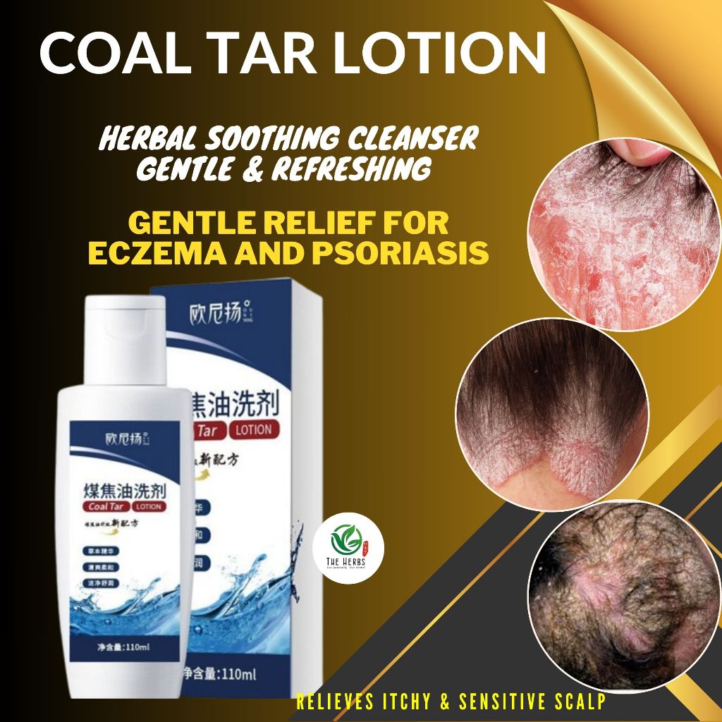 COAL TAR LOTION 110ml 煤焦油 ANTI-DANDRUFF ANTI-ITCH Eczema relief Anti ...