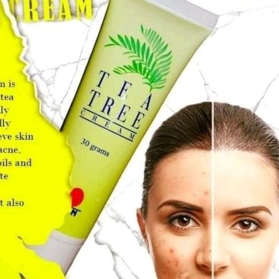 TEA TREE CREAM [30gm] (Removes acne scars,pimples & dark spots ...