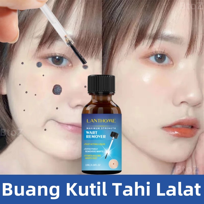 Ubat ketuat Skin tag Buang Kutil Tahi Lalat Obat mata ikan Wart Removal ...