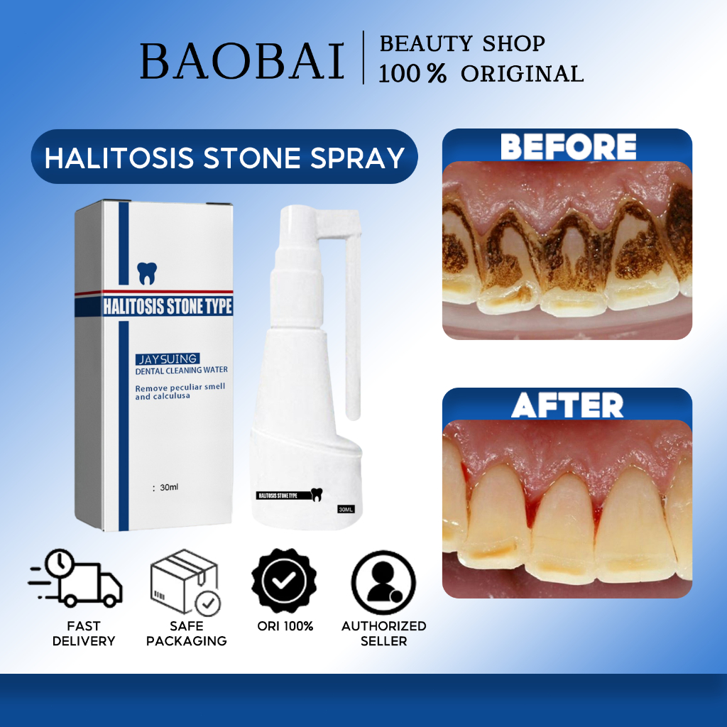 Jaysuing Teeth Stone Remover 30g Tartar Remover Spray Pemutih Gigi ...