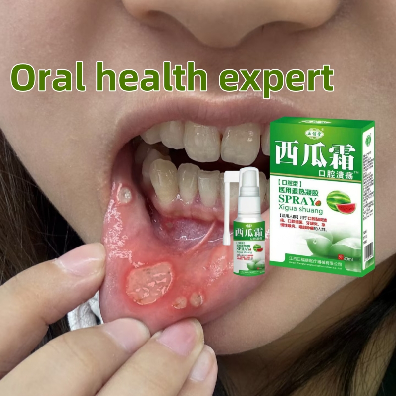 Mouth Ulcers Zhengxintang watermelon frost spray Sore throat mouth ...