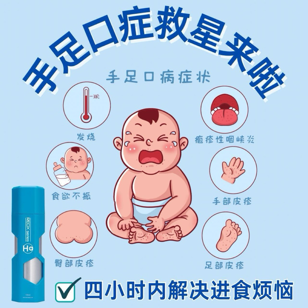 RETURN LEGACY REOX SERIES H+ Hplus (70ML）负氢离子多功效喷雾/手足口症/敏感/止痒/消炎/修复 ...