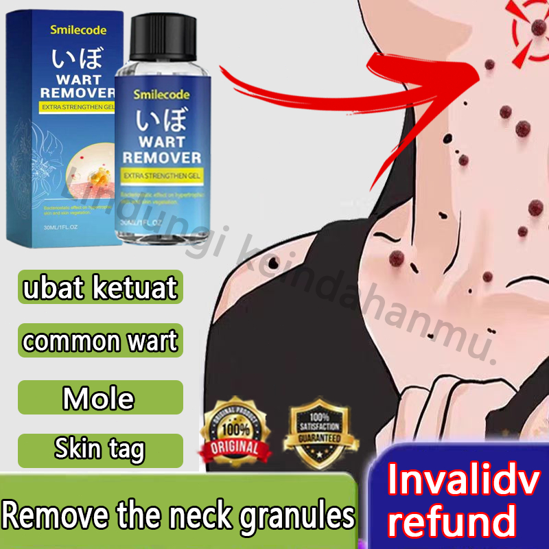 Ubat ketuat Tahi lalat remover Skin Tag, Mole, Corn & Wart Removal 30ml ...