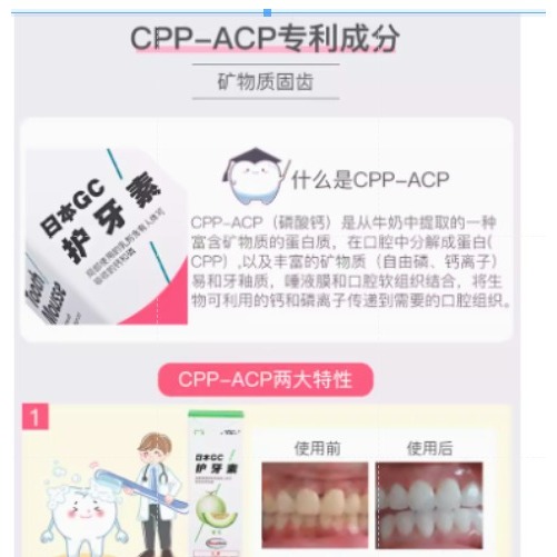 GC Tooth Mousse Plus(With Additional Fluoride, CPP-ACPF) | Shopee Malaysia