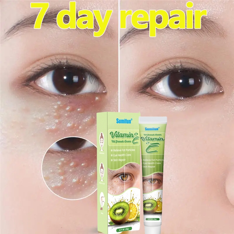 vitamin E eye cream Krim Milia Seed Remove Fat granule Grease grains ...