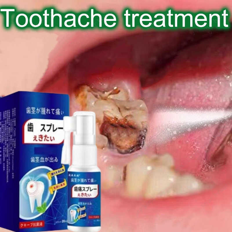 Ubat Sakit Gigi Berlubang Toothache Spray Obat Sakit Gigi Ubat Gusi ...