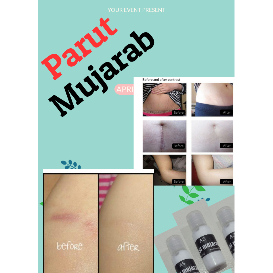 parut mujarab. ,krim parut,parut mujarab,parut lama,parut baru,krim ...