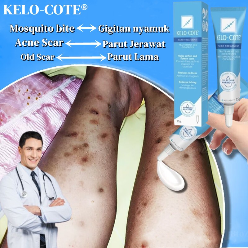 Scar removal cream Krim hilangkan parut hitam bayi krim parut kaki ubat ...