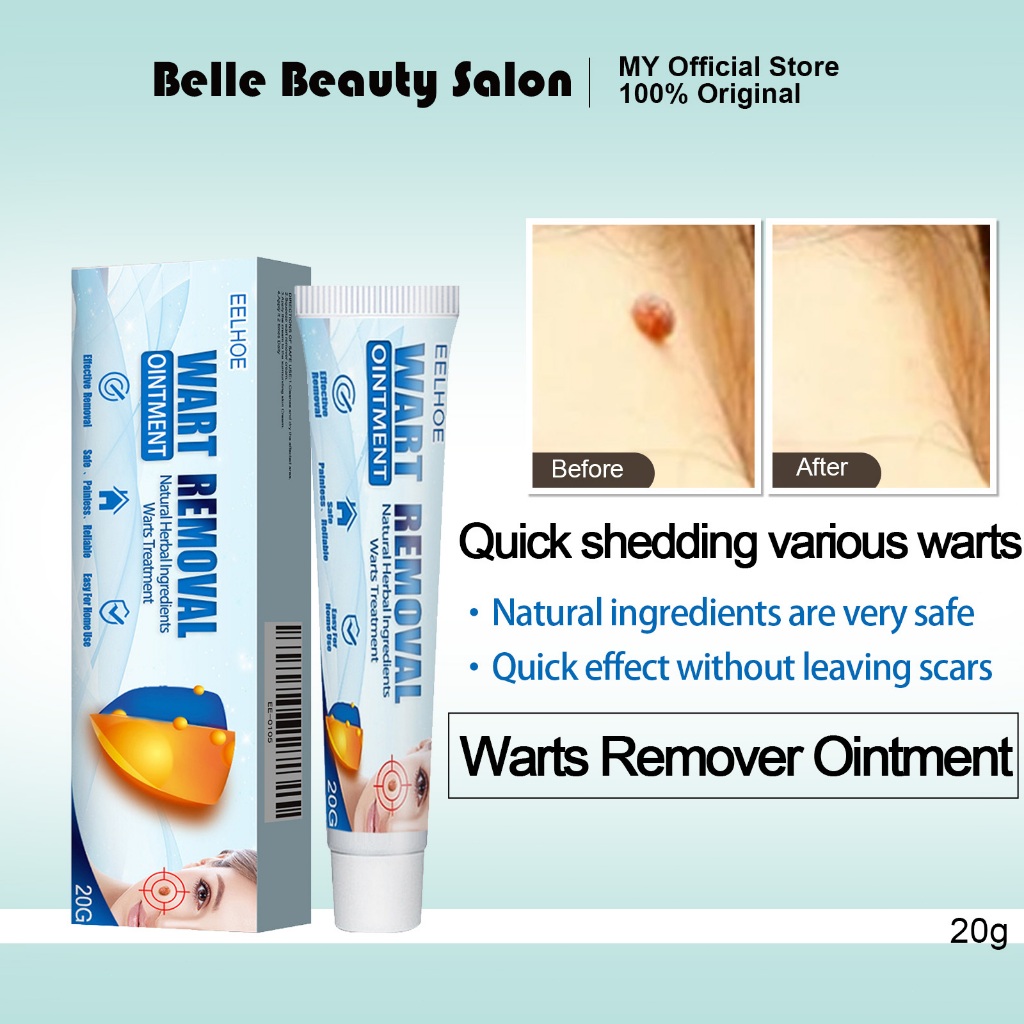 Wart Remover Ointment 20g ketuat remover Warts removal cream Kutil ...