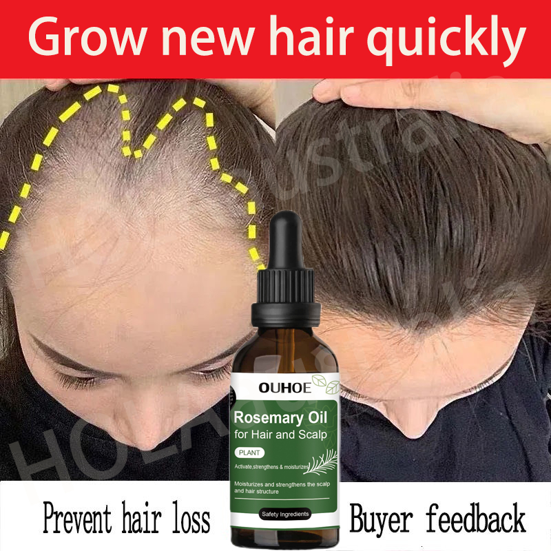 Hair Growth Serum Hair Tonic Serum Minyak Lebatkan Rambut serum rambut ...