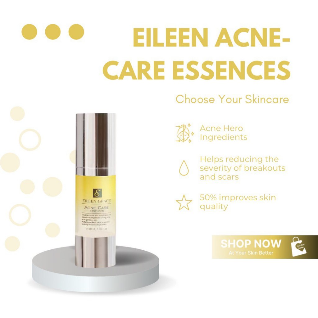EILEEN GRACE ACNE CARE ESSENCES 30ML - DRY SKIN - HILANGKAN PARUT JEAWAT - ACNE SPOT TREATMENT ...