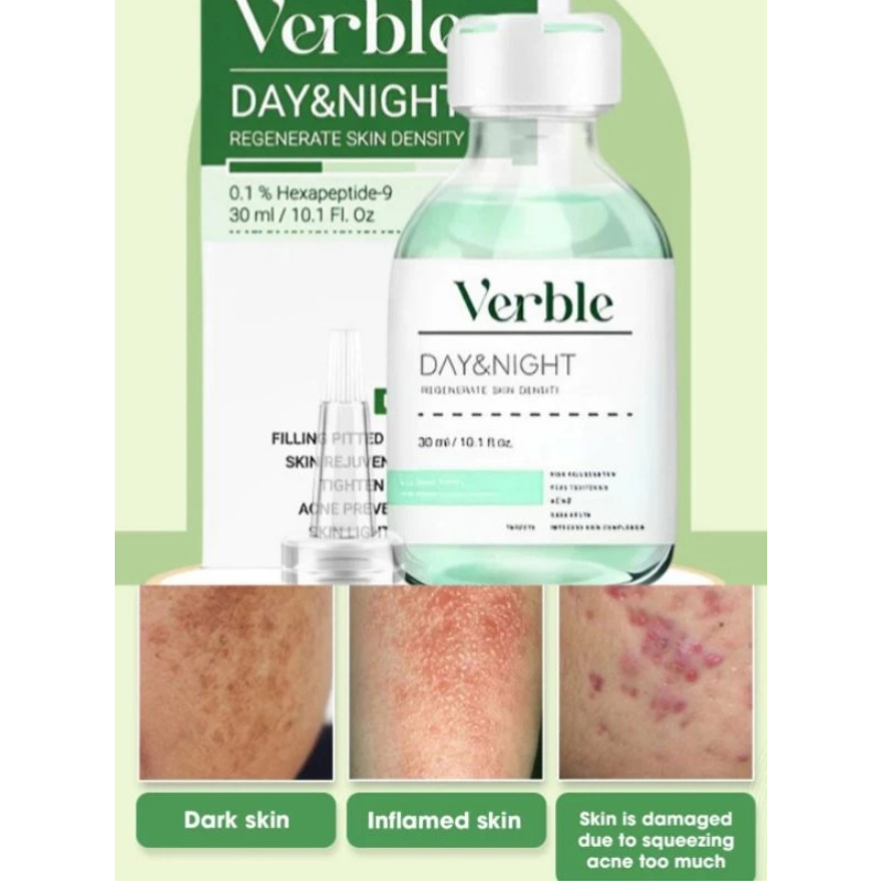 VERBLE serum pitted scar reduce dark spots brighten skin | Shopee Malaysia