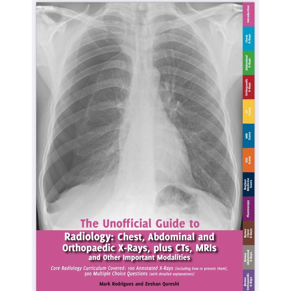 The Unofficial Guide to Radiology: Chest, Abdominal, Orthopaedic X Rays, plus CTs, MRIs and ...