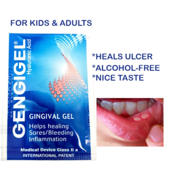 Gengigel Gel 1ml Sachet (Mouth Ulcer Medication) | Shopee Malaysia