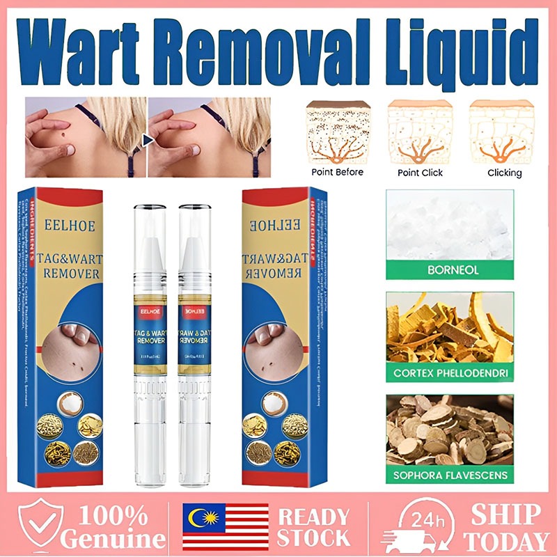 🔥【Ready Stock】Upgraded Ubat Ketuat Tahi Lalat Skin Tag Remover Pen ...